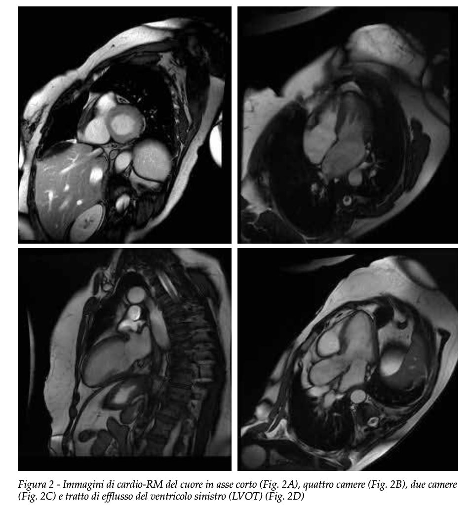 Imaging cardiaco tra presente e futuro. Cardio-TC e Cardio-RM | I Campanacciani